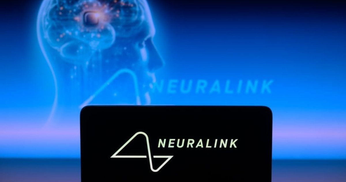 Δείτε τον πρώτο άνθρωπο με εμφύτευμα της Neuralink να κινεί το mouse με ...