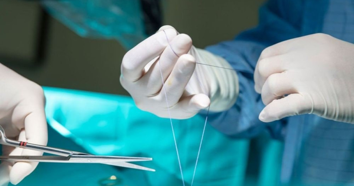 Ταχύτερη επούλωση πληγών με ράμματα που παράγουν ηλεκτρικό φορτίο!